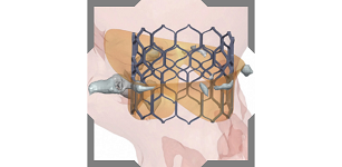 Healthcare professionals - FEops